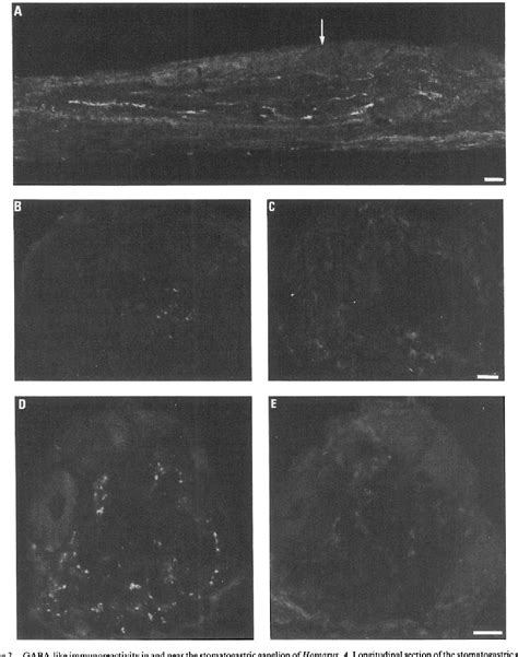 Figure 2 From Suppression Of Oscillatory Activity Implication Of Gabaergic Inputs Semantic Scholar