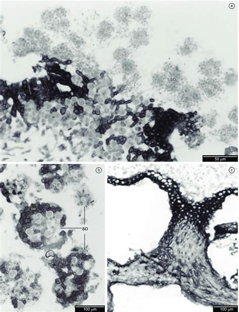 Physcia Under Microscope