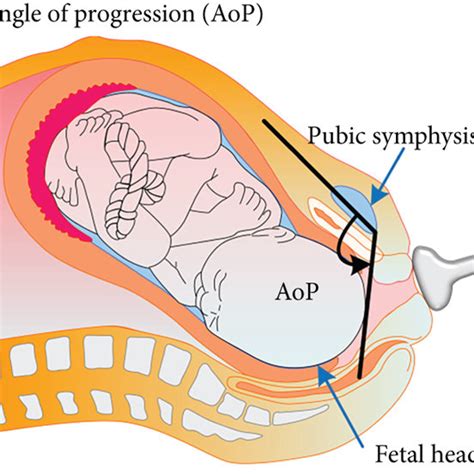 Illustration Diagram Of The Proposed Algorithm For Automatic