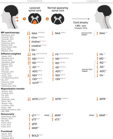 Hallmarks Of Spinal Cord Pathology In Multiple Sclerosis Journal Of