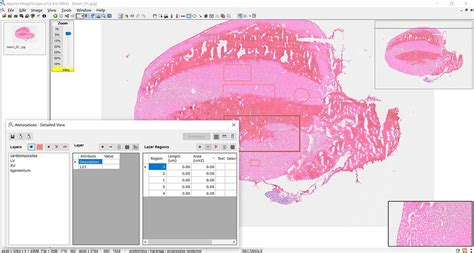 imagescope annotations length and area are zero usage and issues
