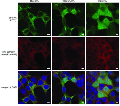 Subcellular Distribution Of Wt Hbe And Hbe3ca Derived Precore Forms