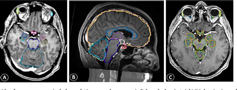 Figure 1 From Deep Learning Magnetic Resonance Imaging Based Automatic Segmentation For Organs