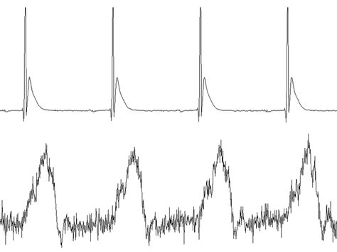 Synchronous Recording Of Electrogram By Touch Free Method Top One Download Scientific Diagram