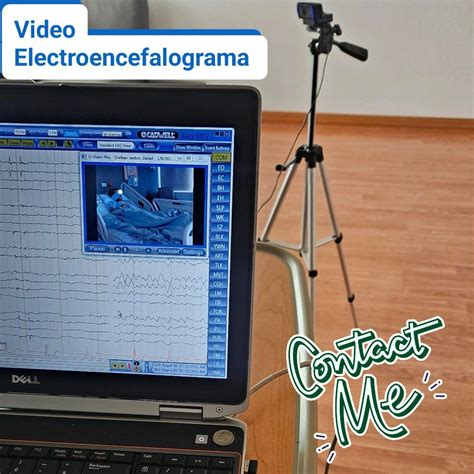 Video Electroencefalograma En Hospital Neurodiagnóstica Mx