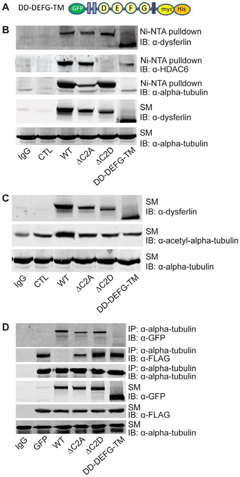 Dysferlin Requires Its Alpha Tubulin Binding Domains To Bind Hdac6 And