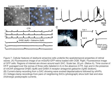 63 Formation Of Early Retinal Circuits In The Inner Plexiform Layer