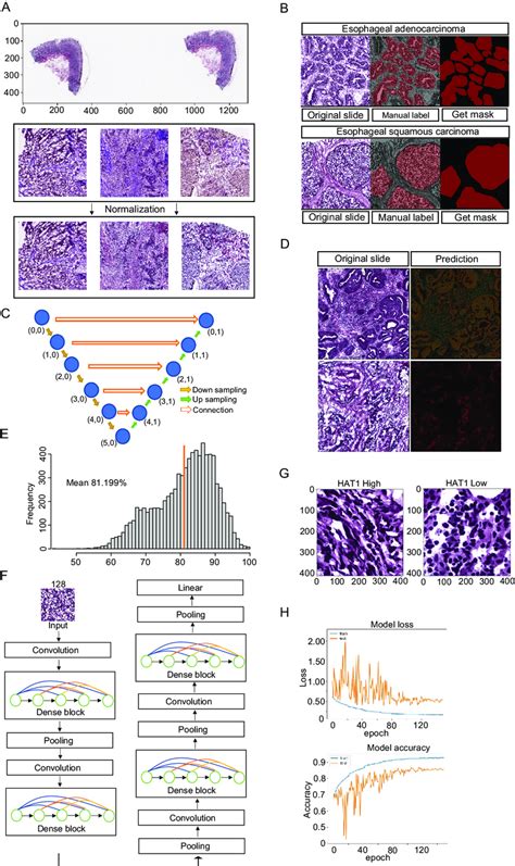 The Construction Of Segmentation And Classification Models A The Download Scientific Diagram