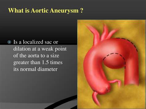 Ppt An Najah National University Faculty Of Nursing Dr Aidah Abu