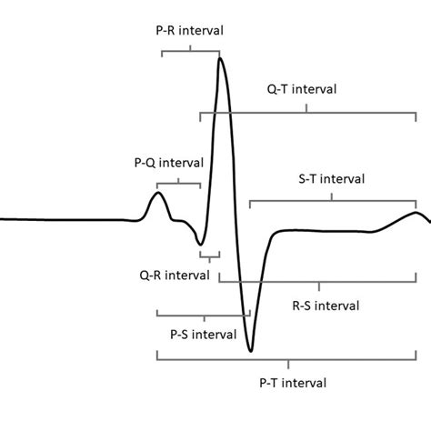 All Waveform Features Of A Classic Ecg Signal This Includes Small Peak