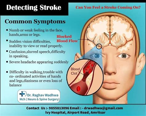 Potential Warning Signs And Symptoms Of A Stroke Artofit