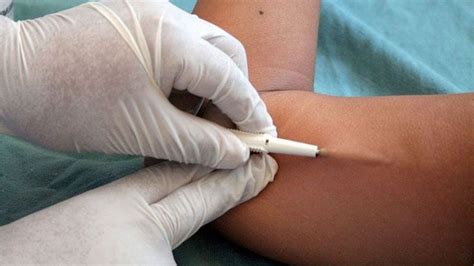 Subdermal Contraceptive Implants Market Key Strategy Revenue