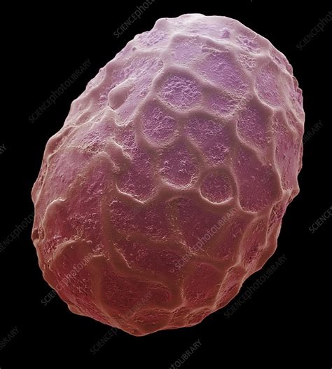 Nematode Egg Sem Stock Image C033 3314 Science Photo Library