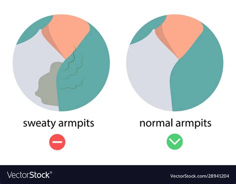 Hyperhidrosis Wet Armpits Excessive Sweating Vector Image