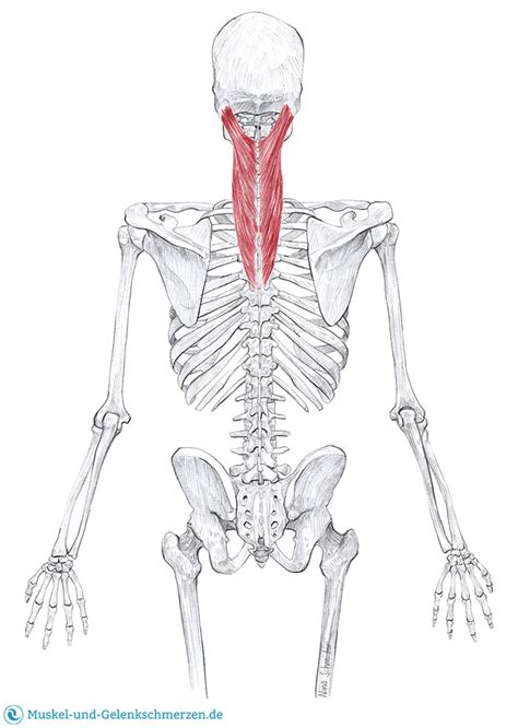 Splenius Capitis Cervicis Trigger Pain Point Referred Triggerpoints