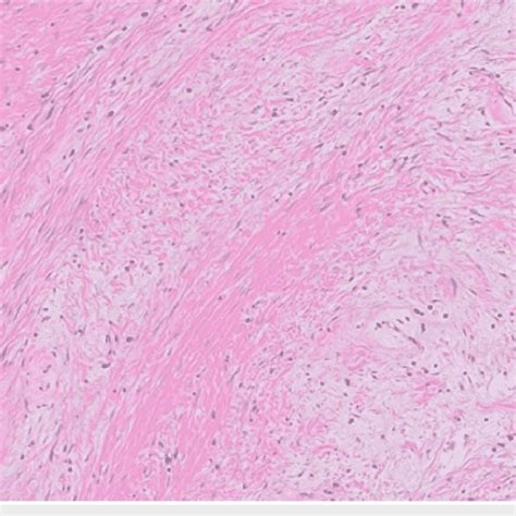 Photomicrograph Of Hande Stained Tissue Section At 100x Original Download Scientific Diagram