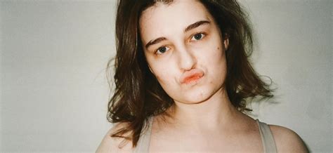 Cold Sore Vs Pimple On Lip What You Need To Know Laifen Us