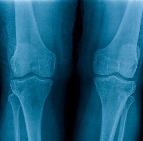 Making Quality Radiology Services More Affordable And Accessible By