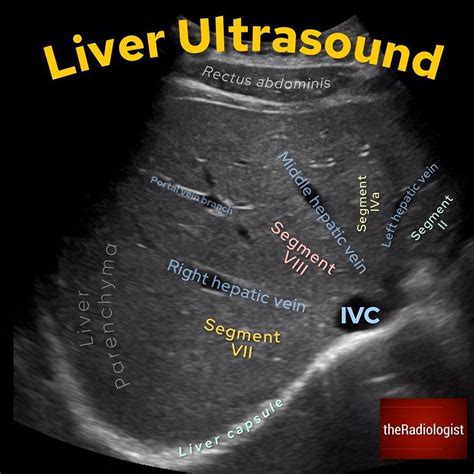 Labeled Abdominal Ultrasound Images At Brandon Myers Blog