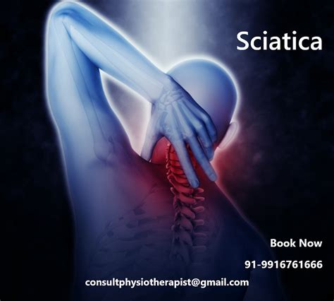 Understanding Sciatica Causes Symptoms And Effective Treatment By