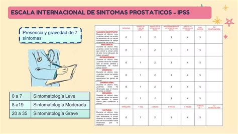 Hiperplasia Prostática Benigna Pptx