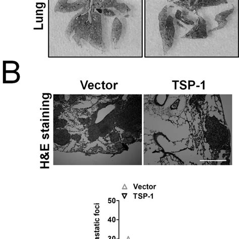 Thrombospondin 1 Tsp 1 Overexpression Inhibits The Malignancy Of