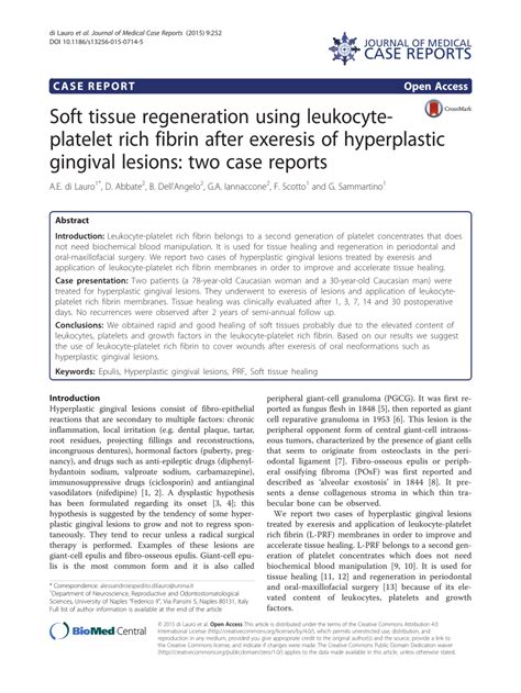 Pdf Soft Tissue Regeneration Using Leukocyte Platelet Rich Fibrin After Exeresis Of