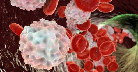 Hyperlymphocytose Causes Symptômes Et Conduite à Tenir