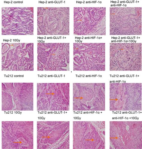 Cell Membrane Rupture Cell Loss Nuclear Concentration Nuclear