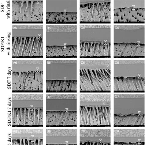 Representative Sem Micrographs Of Hybrid Layer Characterization Areas