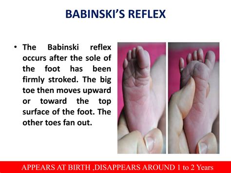 Assessment Of Newborn Reflexes Pptx