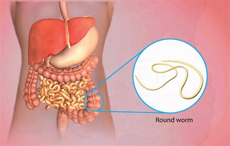 Health Condition Symptoms Causes Treatment And More