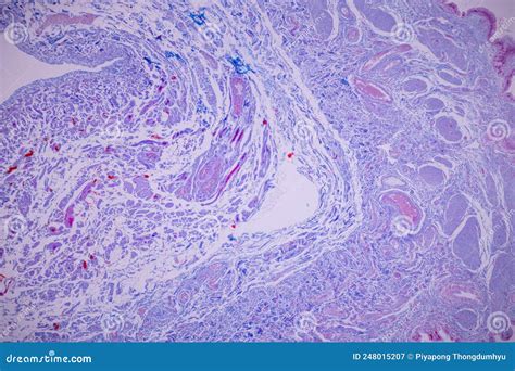 Columnar Epithelium Of Human Gall Bladder Under The Microscope In Lab