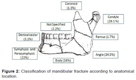 Newer Proposed Classification Of Mandibular Fractures A Critica