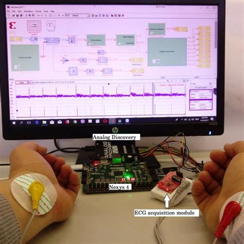 Top Level Implementation Diagram Of The Proposed Architecture For Qrs