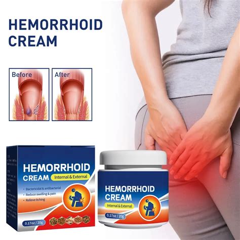 Hemorrhoid Treatment Cream