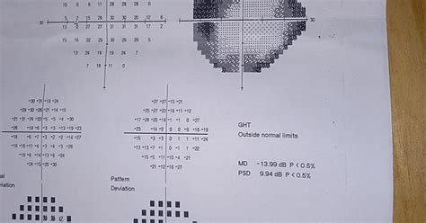 My Condition Is Not Getting Better I Dont Have But A Few Options Left