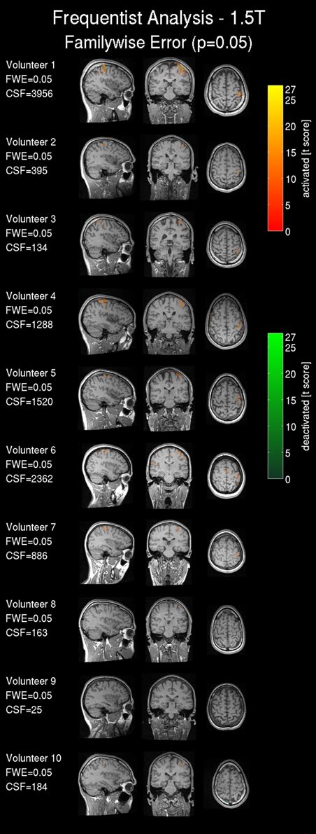 Frequentist Analysis For The 15t Intra Operative Scanner Similarly