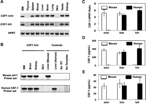 Expression Of Human Csf 1 In The Humanized Csf 1 Mice A Indicated