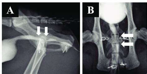 Retrograde Urethrography Showed A Stricture Of The Pelvic Urethra Download Scientific Diagram