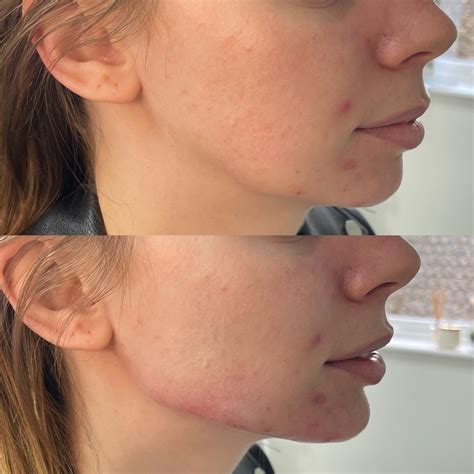 Grace Byng Aesthetics Home Facebook