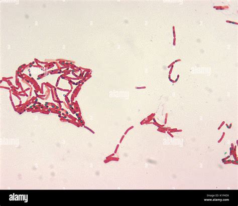 Bacillus Subtilis Spore Stain