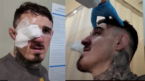 Tom Aspinall Says All That Training For That After Ufc 321 Eye Poke