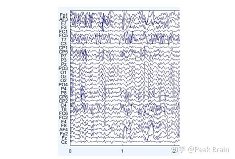 独立主成分分析(ica)应用 从脑电中去除眼电 知乎 独立主成分分析(ica)应用 从脑电中去除眼电 知乎
