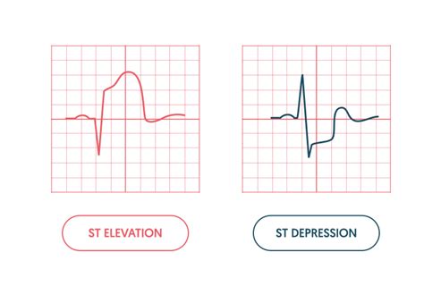 Github Yijing917predictyourheartanalysis