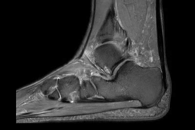 Ankle With Compressed Sense Philips Mr Body Map