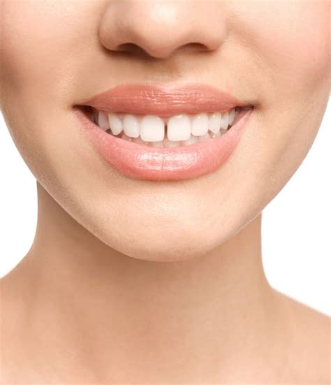 Spaced Teeth New Ash Green Dental And Aesthetics