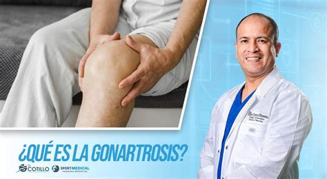 ¿qué Es La Gonartrosis Por El Dr Luis Cotillo Artrosis De Rodilla