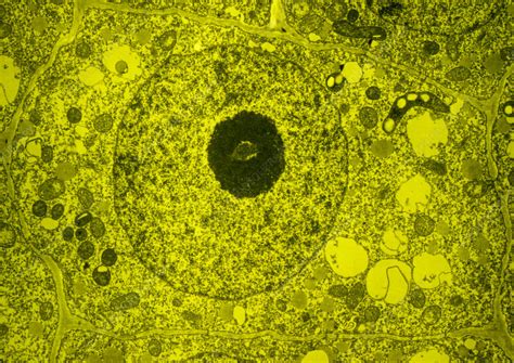 Plant Cell Tem Labeled At Larry Lee Blog