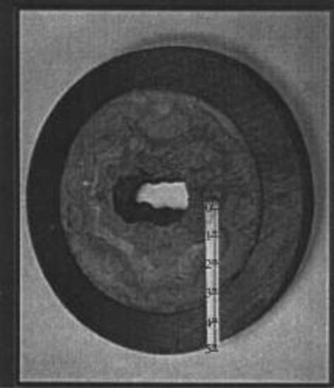 1 Example Of A Pipeline Blockage From Singh Et Al 2000 Download Scientific Diagram